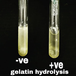 Gelatin Hydrolysis Test | Principle, Uses, Media, Procedure and Result ...