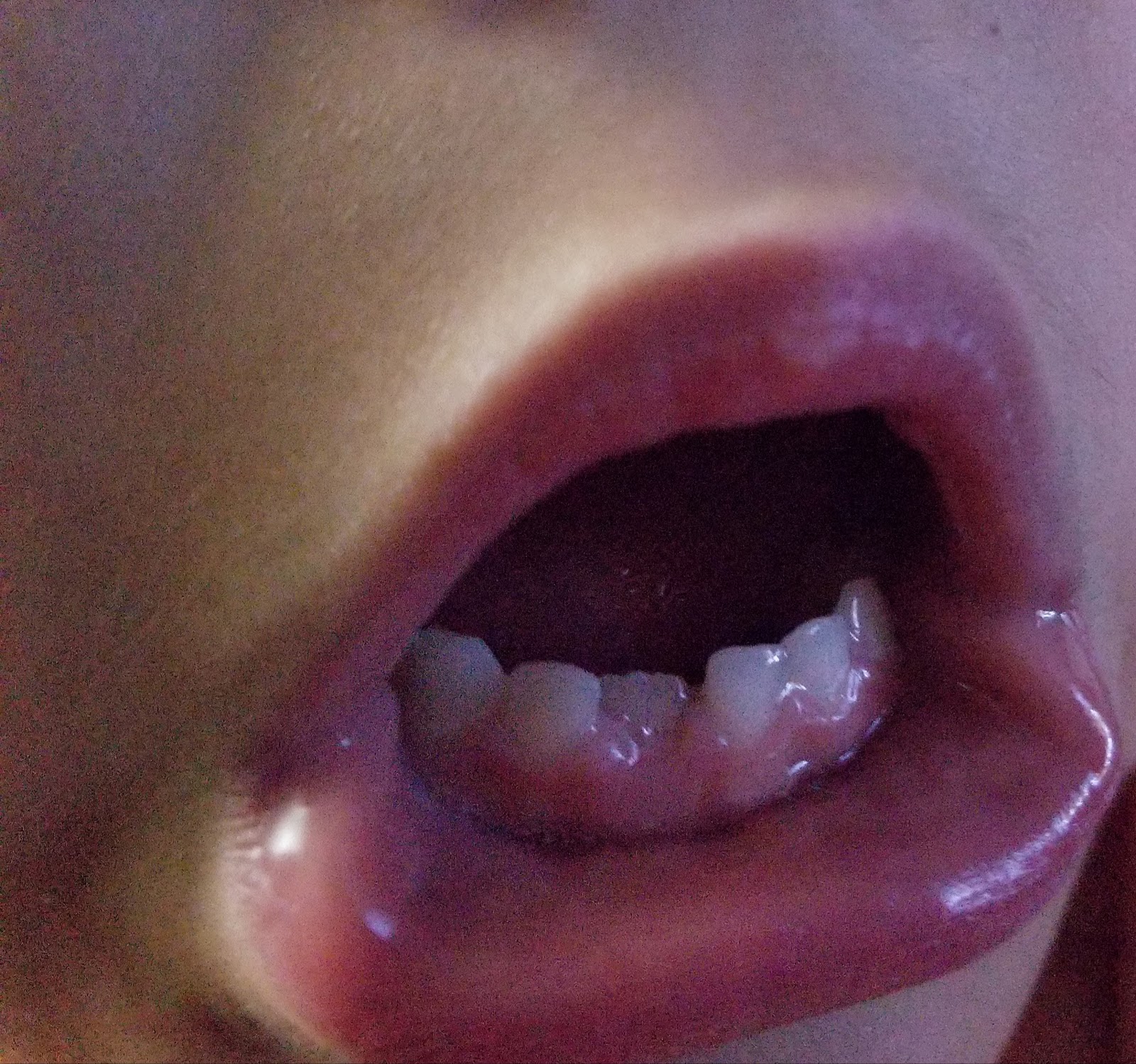 How My Son Lost His First Tooth