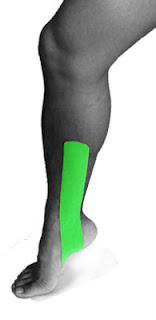 ARES Kinesiology Tape: Shin Splint