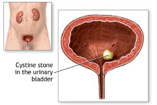 lebioging.blogspot.com: HEREDITAS