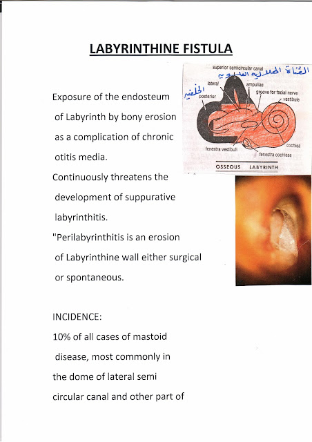 المدونة الطبية د.فهيد سالم السبيعي: LABYRINTHINE FISTULA