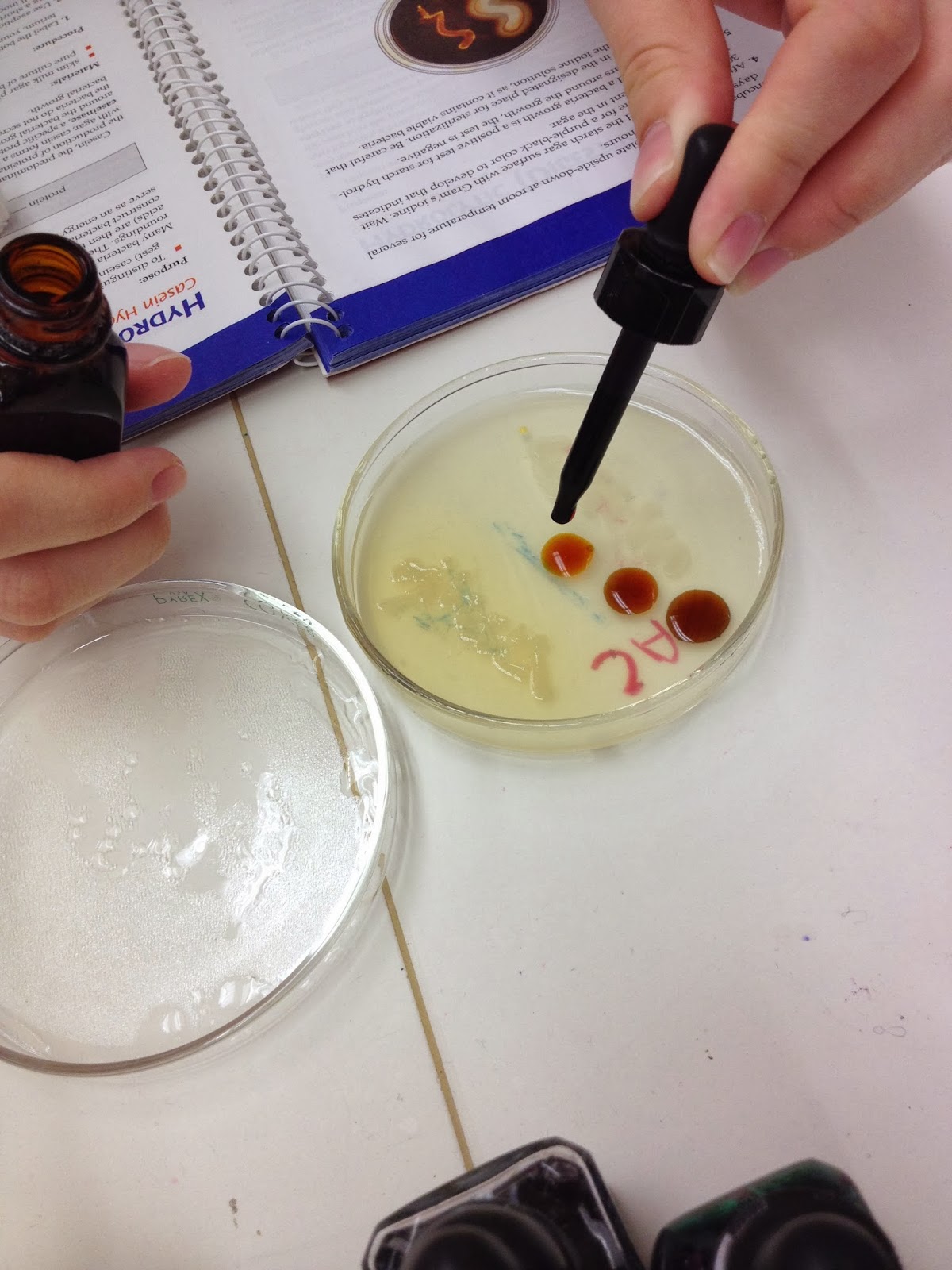 Rose & Lindsey's Medical Microbiology Blog: Starch Hydrolysis Test