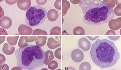 VETERINARY HEMATOLOGY DEXTERVET: Monocyte, normal