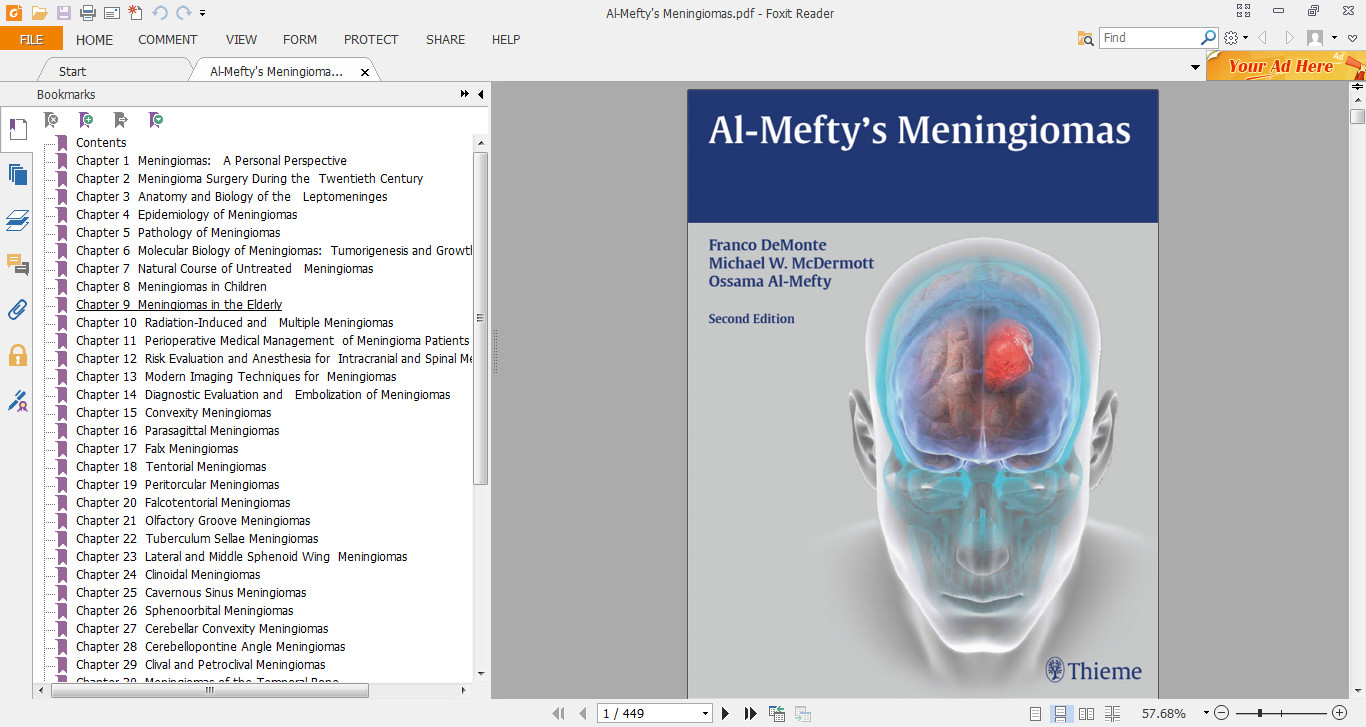 Ebook Al-Mefty's Meningiomas 2nd Edition ~ Neurosurgery Books