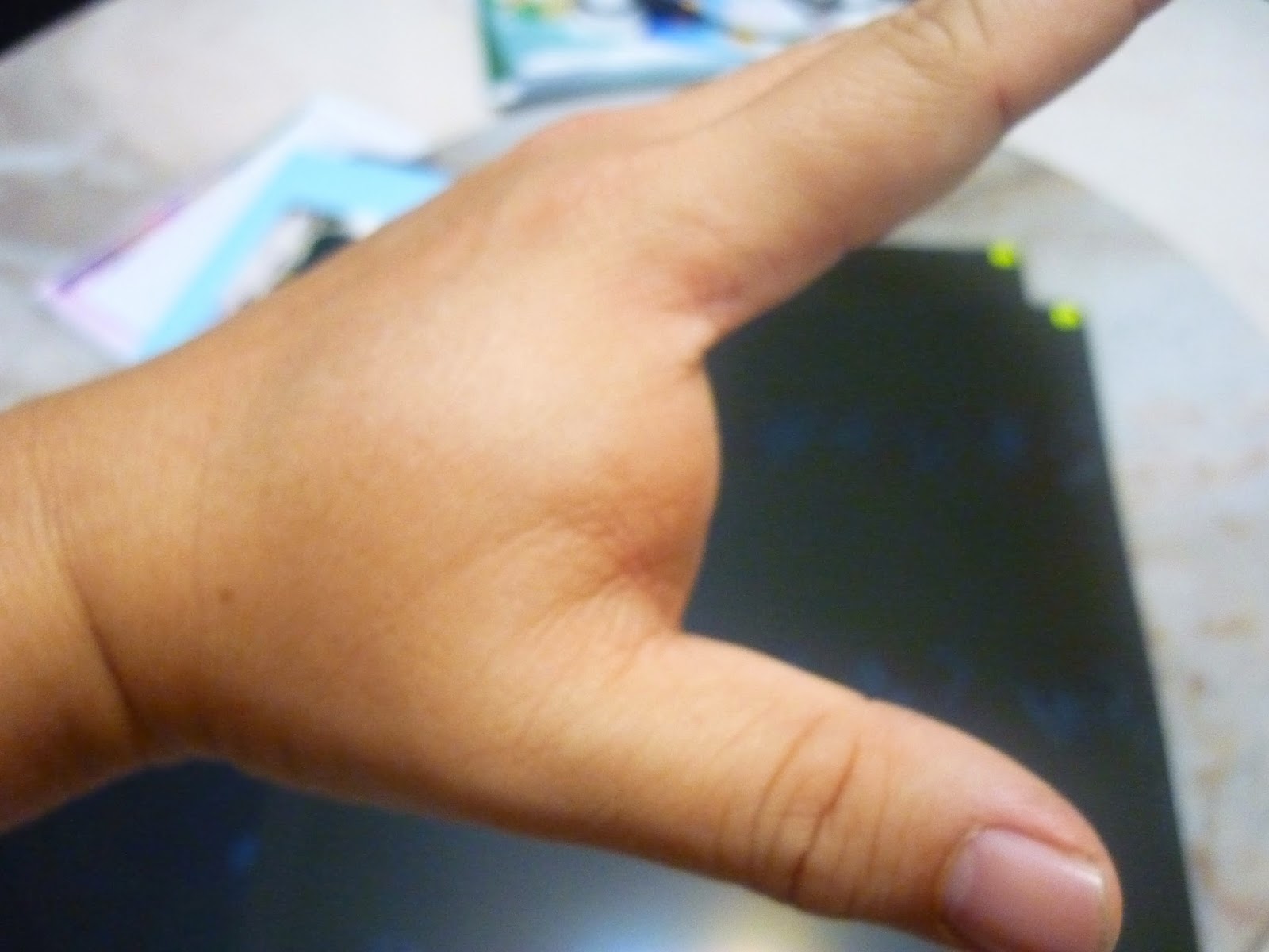 david 3816: Lipoma (Skin Lumps)