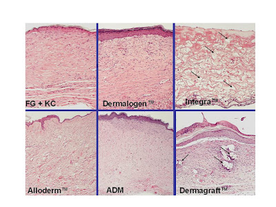 My unpublished biomedical research: Wound Healing and ...