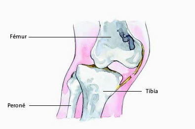 PEDIAFX: Fracturas en rodilla