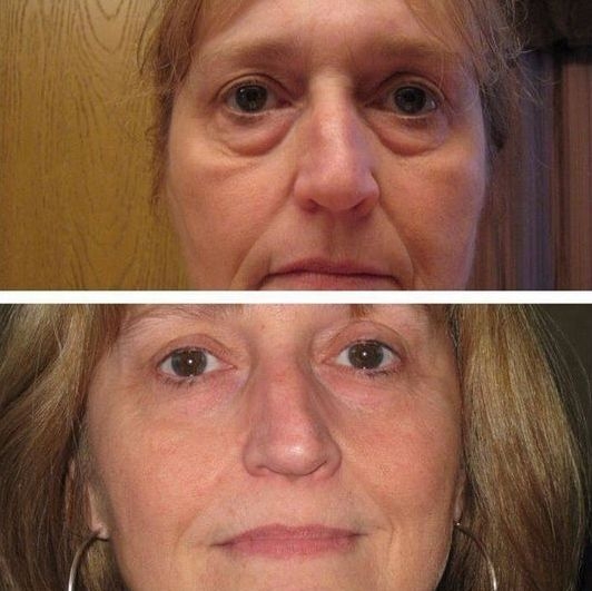 Face Toning Workouts Towards A Natural Nodal Facelift: Glean Awesome ...