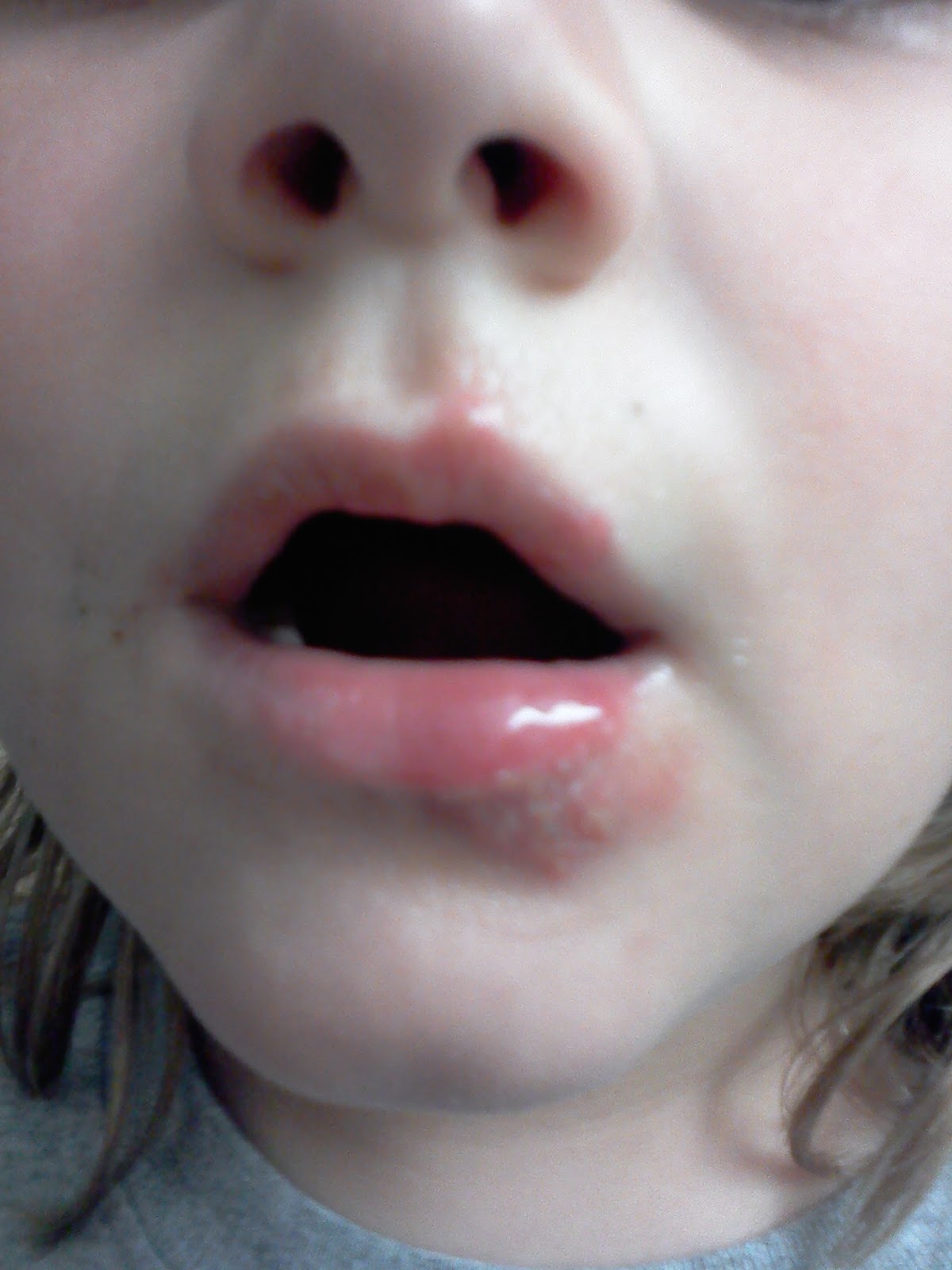 Life with Lupus: DJ's battle