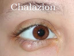 Semiología Quirúrgica Dra. Leroux R.: Examen cabeza y cuello