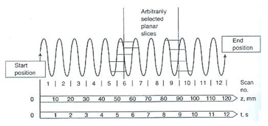 บันทึกของลูกช้างรังสี: หลักการทำงานของ Spiral CT.
