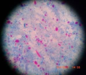 Phimaimedicine: 1,088. Cryptosporidium suspect