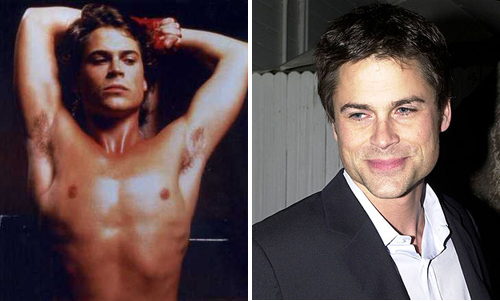 Rob Lowe Plastic Surgery