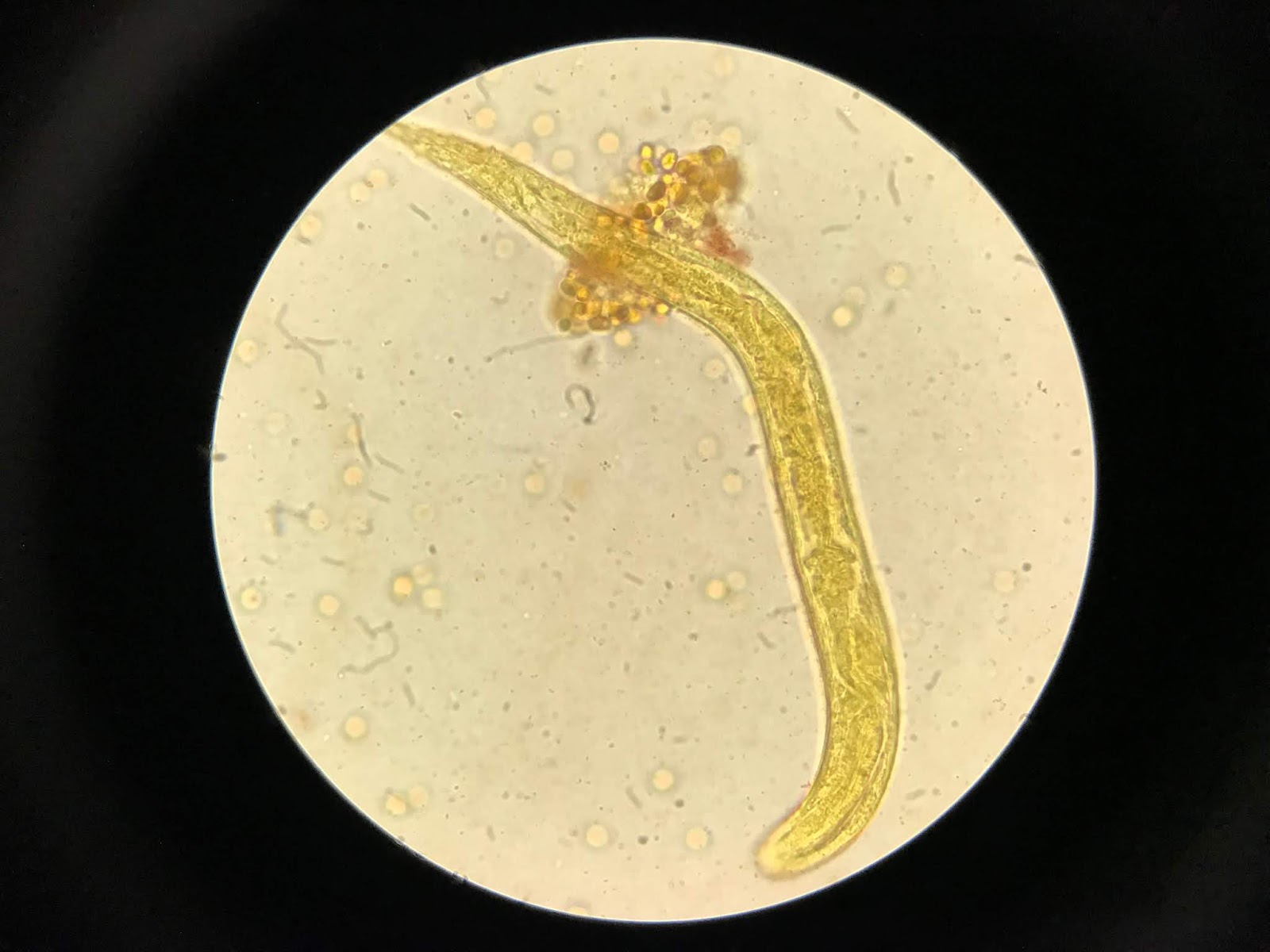 Creepy Dreadful Wonderful Parasites: Case of the Week 499