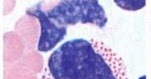 FICHERO HEMATOLOGIA : Mielocito eosinófilo