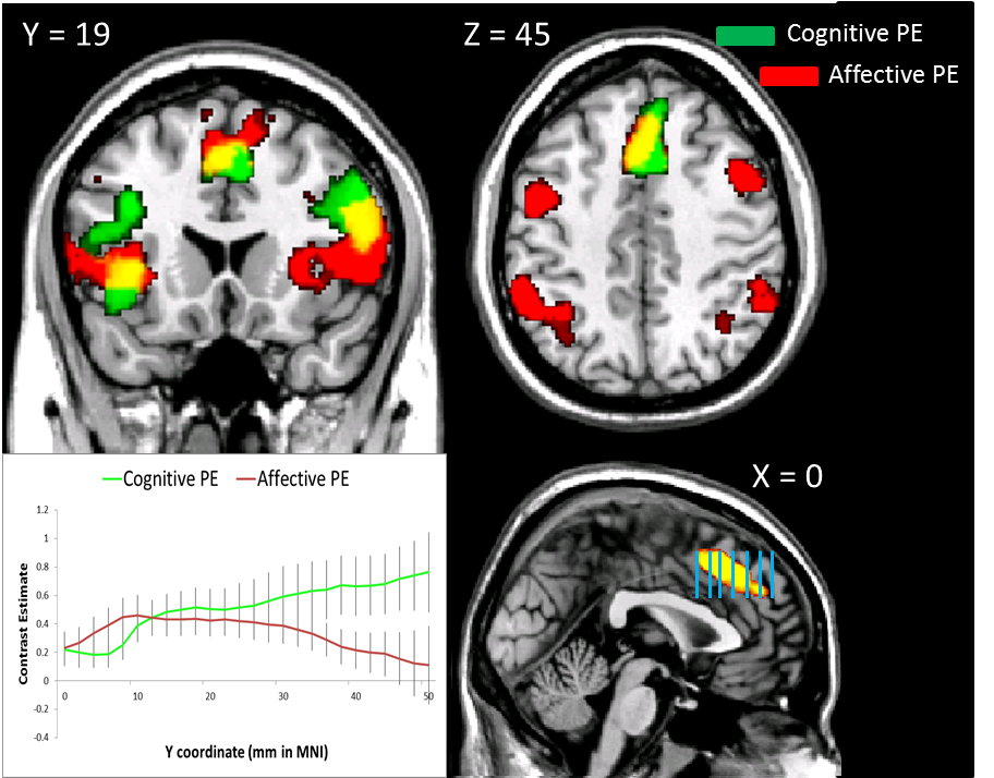 Andy's Brain Blog: Slice Analysis of FMRI Data with SPM