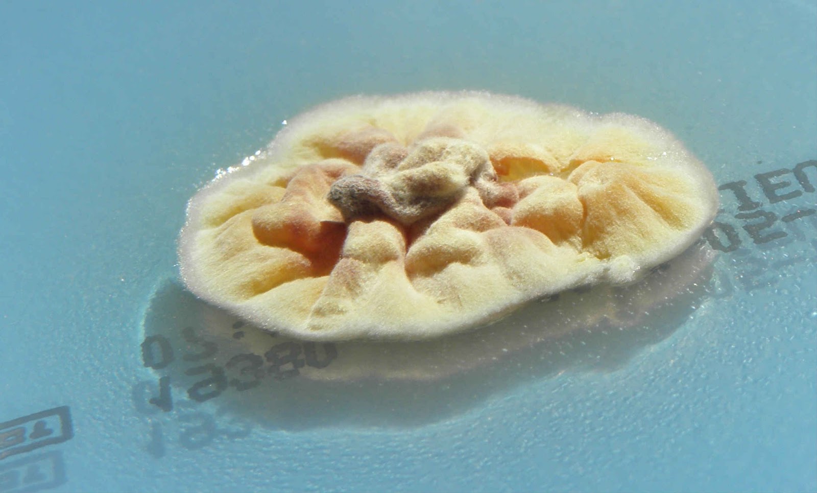 ATLAS MICOLOGIA: TRICHOPHYTON SOUDANENSE