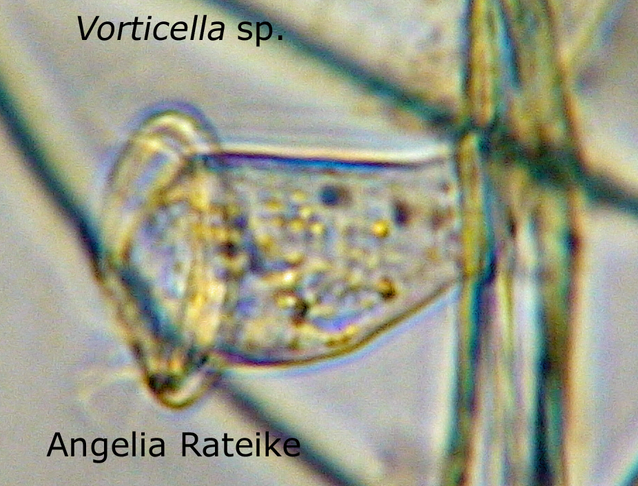 Vorticella Labeled