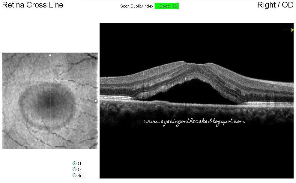 eyecing on the cake: September 2015