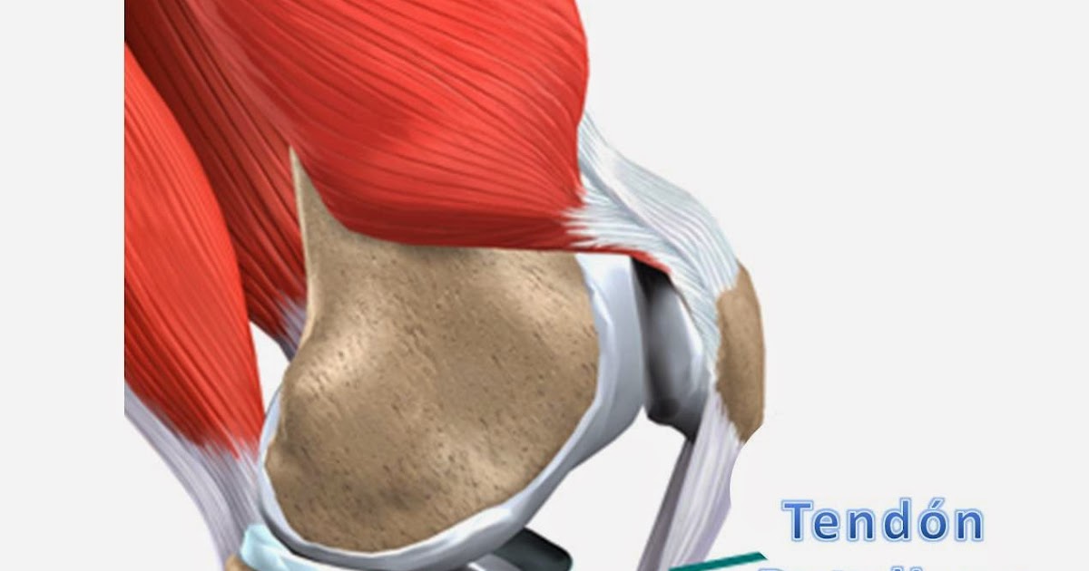 Anatomia Mallorca Universidad Isabel I: Tendinitis Rotuliana