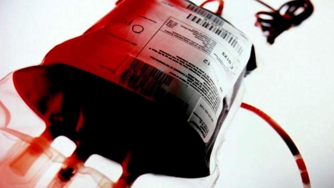 MICROBIOLOGIA ODLT: "TRANSFUSION SANGUINEA"