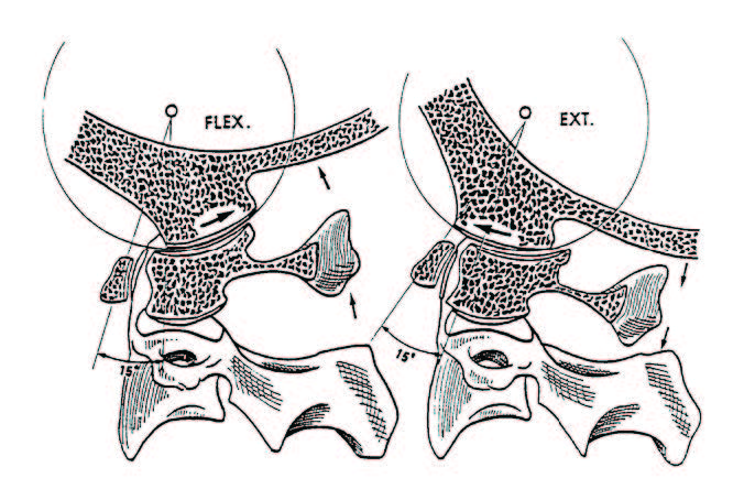 Cervicogenic Headaches Present in Athletes