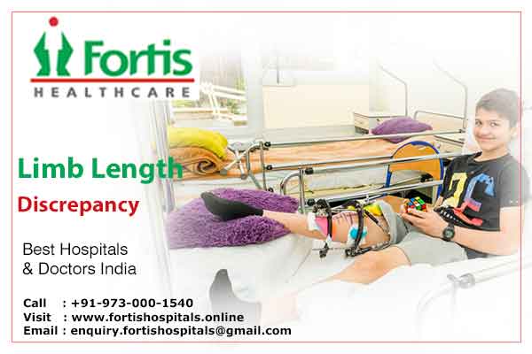 Treatment Options for Limb Length Discrepancy - Fortis Hospitals