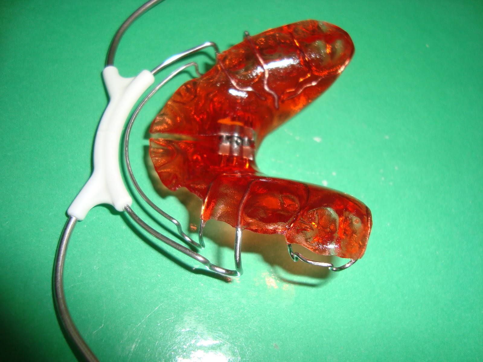 Laboratório Ortodôntico Bohrer: APARELHO THUROW