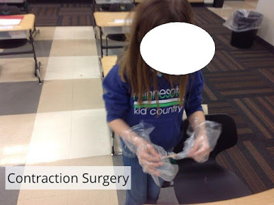 Teaching Little Miracles: Contraction Surgery
