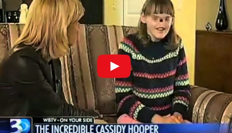 Girl Born With No Eyes or Nose Receives a Miracle - Amazing story of ...