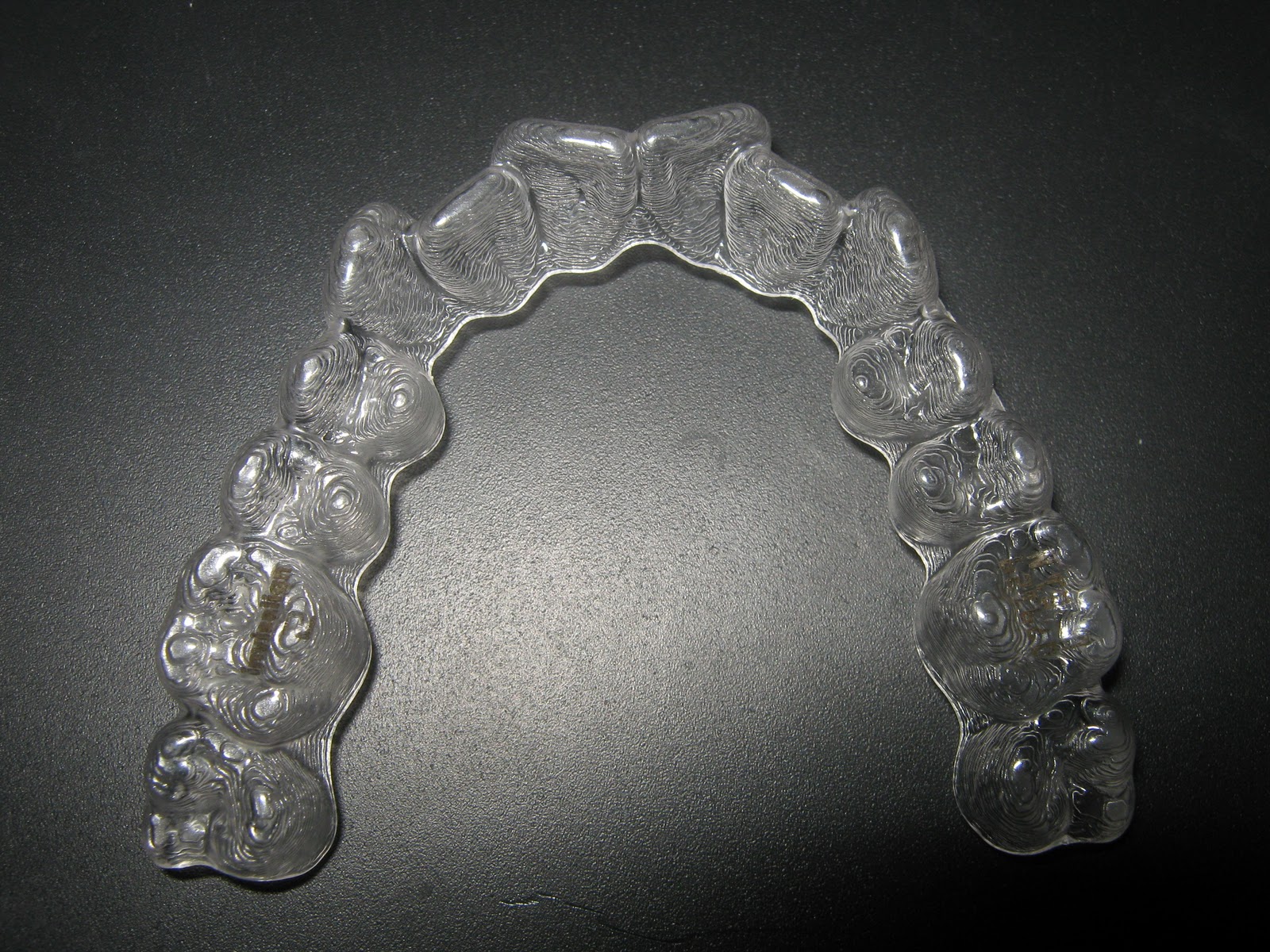 Br@ndy's Invisalign Journey: Tray 10