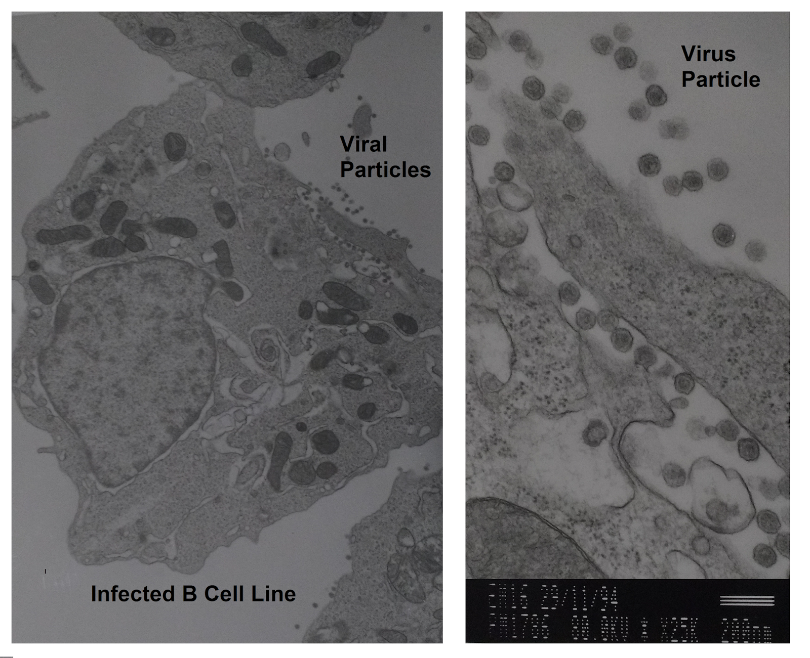 Multiple Sclerosis Research: What Did the B Cell Video Miss? Multiple Sclerosis Research: What Did the B Cell Video Miss?