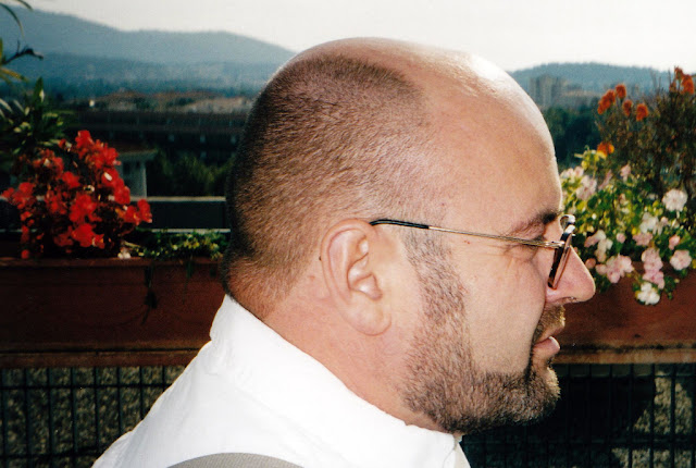 EL CALVARIO DE LA CALVICIE: La calvicie te hace ver más gordo, más ...