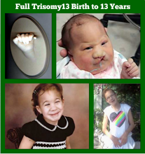 Trisomy 13 Life with Natalia ~ Transformed by Love: Neonatal Research ...