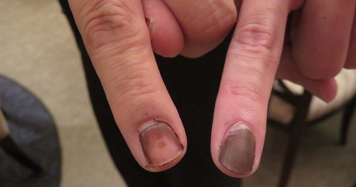 Kee Hua Chee Live!: GREATEST BADGE OF HONOUR---YOUR INK-STAINED FINGER ...