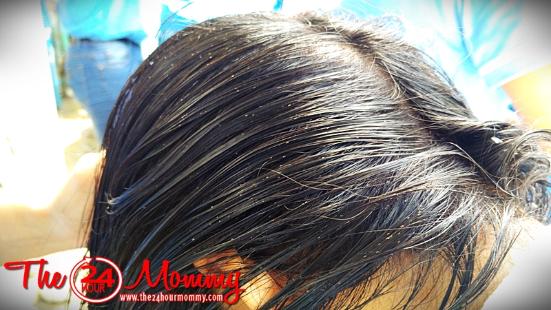 Licealiz's "Kilusang Kontra Kuto" Spreads Awareness About Head Lice ...