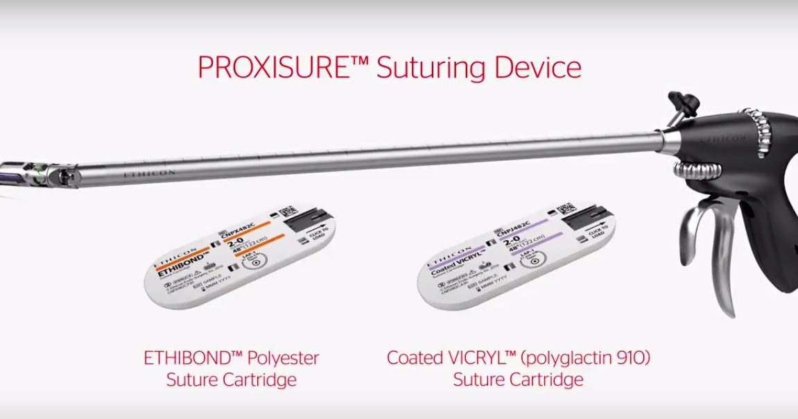 Ob/Gyn Updated : Ethicon launches ProxiSure Suturing Device, improving ...