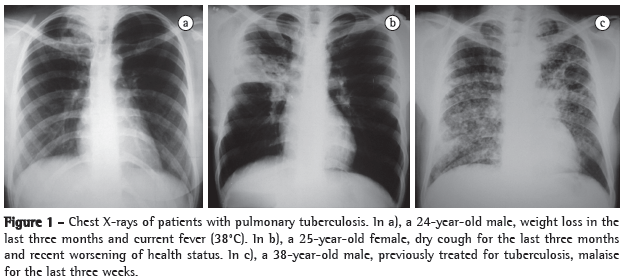 What are the Symptoms and diagnosis of Tuberculosis? | Inside Out Blog