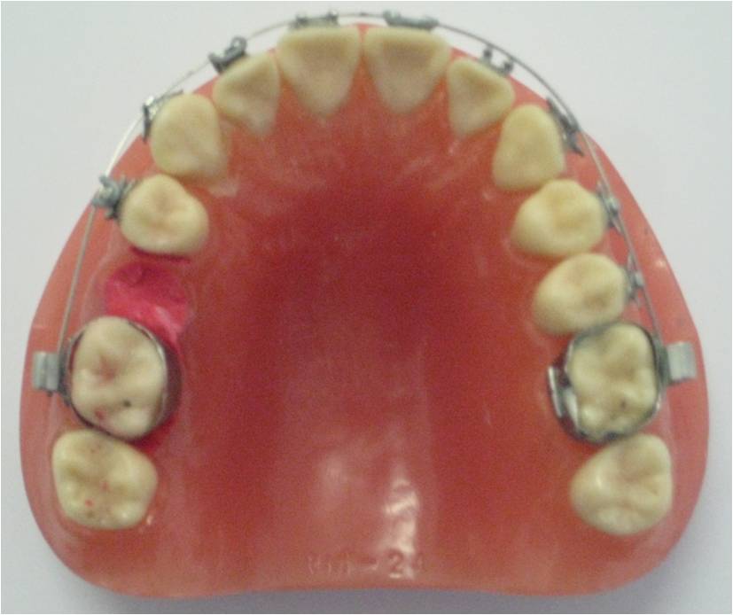 practical orthodontics: Diagnosis and treatment of mesially rotated ...
