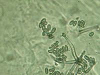 MICOLOGIA PANAMENSIS: Notas Micologicas (143). Observaciones sobre el ...