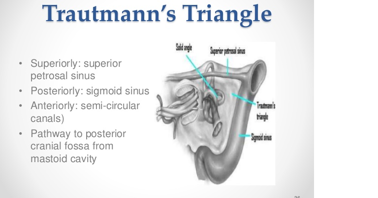 Science Blog: Trautmann's Triangle & Otogenic Brain Abscess