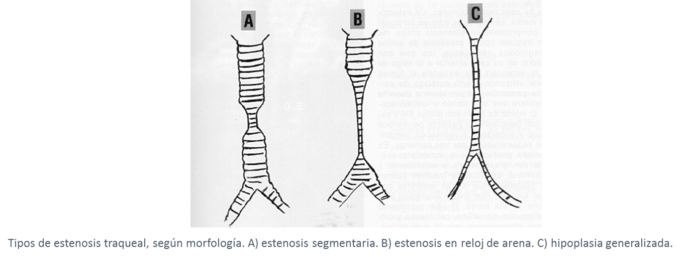 Anomalías Congénitas Respiratorias : septiembre 2013