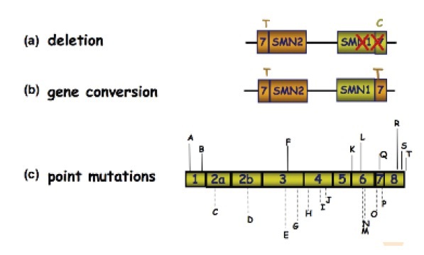 AME PERU: DIAGNOSTICO DE LA ATROFIA MUSCULAR ESPINAL