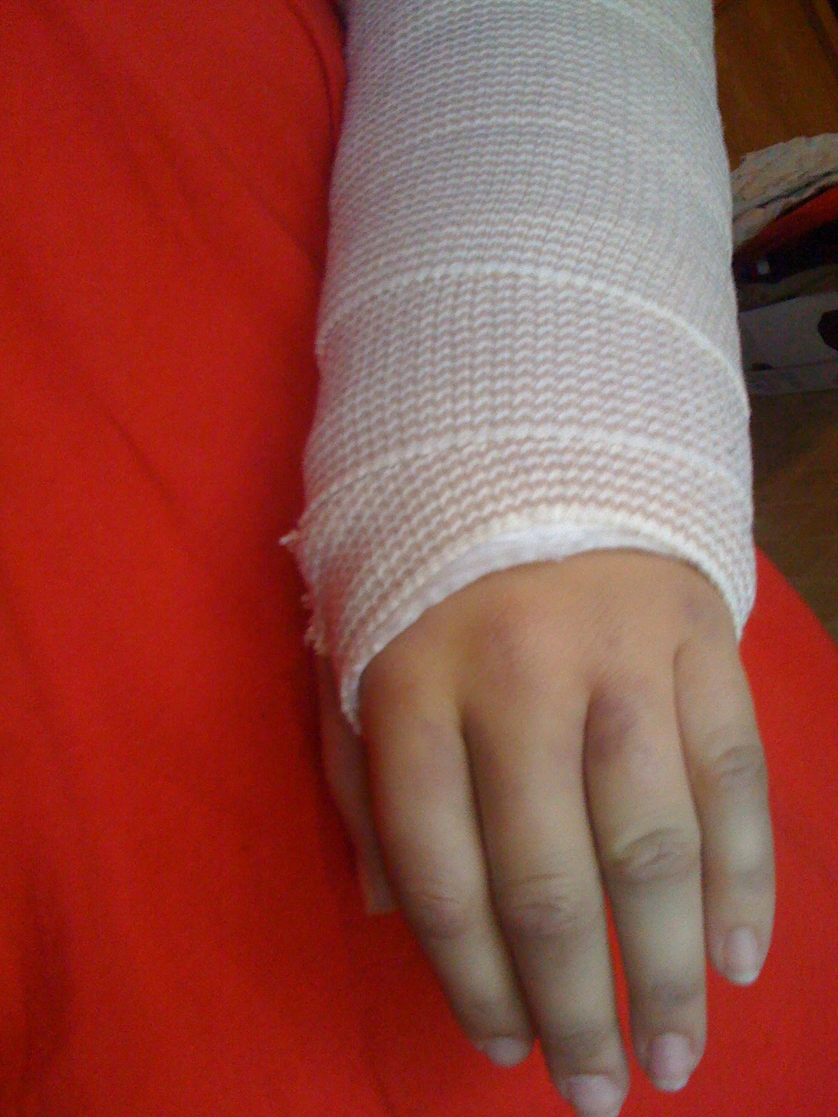 fotos, and fashion, and fun-tastics! oh, my!!!: that pesky broken arm.