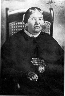 A Grave Interest: Jane Todd Crawford -The First Survivor of Ovarian Surgery