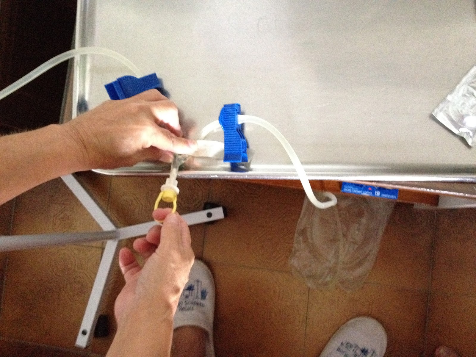 Diálise Peritoneal Ambulatorial Contínua - CAPD - Passo a passo