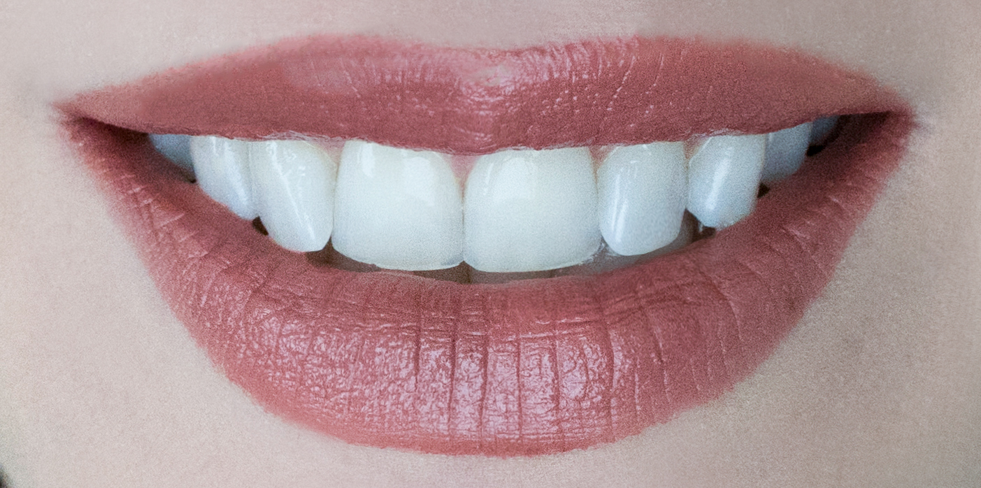 SMILE BRILLIANT REVIEW