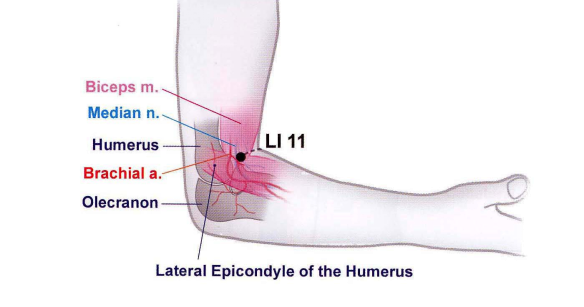 LI 11. Quchi / Ci Ce (Kolam Berliku-liku) - Terapi Jarum