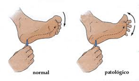 Enfermería Básica UCV : Abdomen y Miembros Superiores e Inferiores