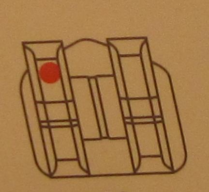 practical orthodontics: Anterior labial root torque